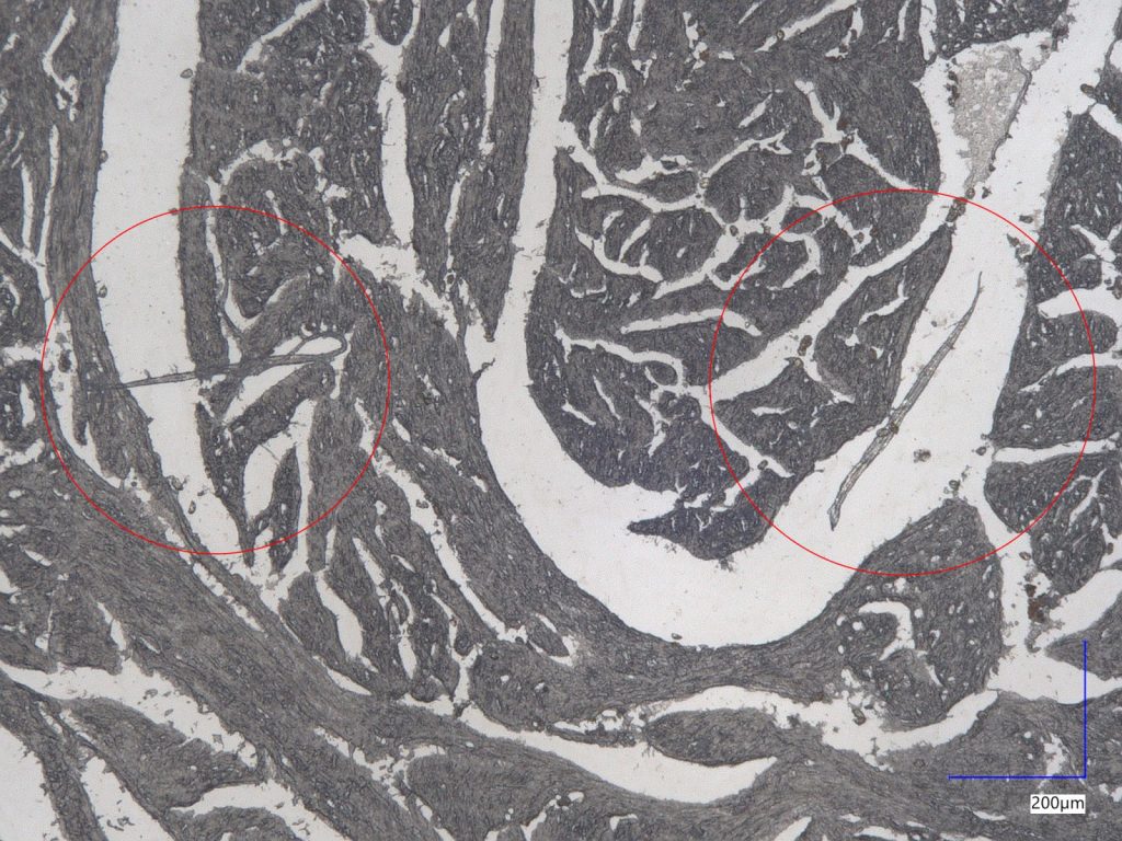 Microplastics found in the reproductive system of sea turtles ...